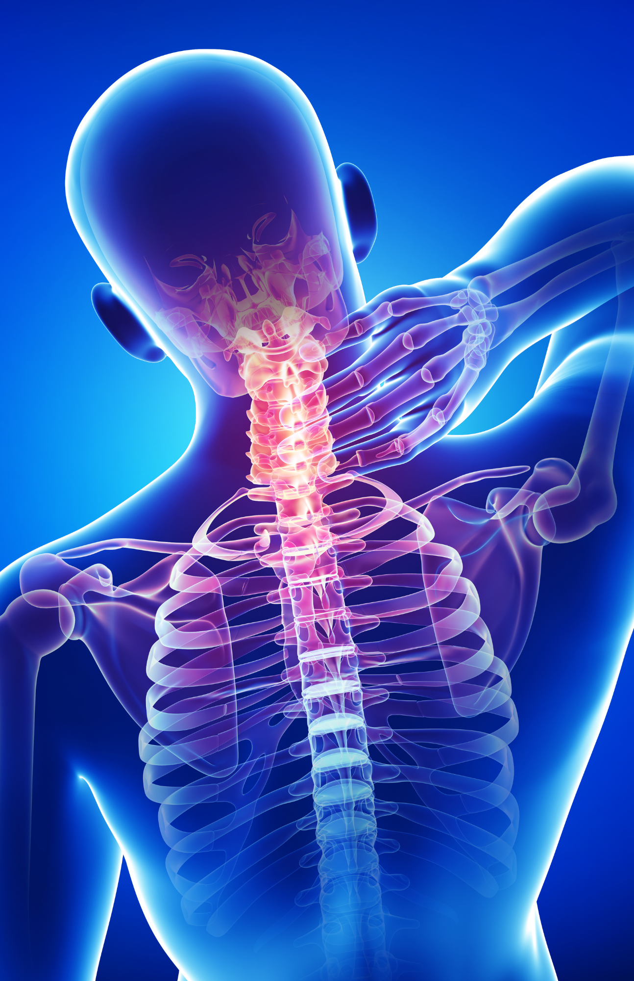 Cervicogenic Headaches and the Role of Spine Instability - Woz Wellness